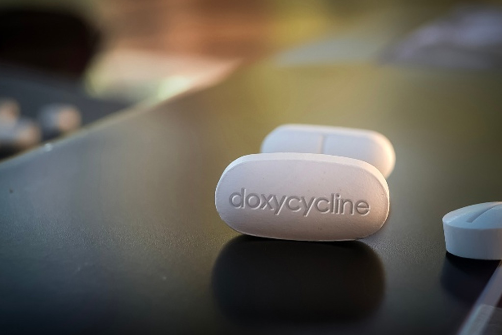 Guía PEP en Chile 2025: ¿Es efectiva? ¿Cómo conseguirla? - Dr. Andi Flores